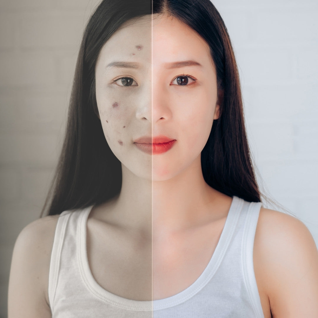 Skin Detan and Dark Spots Solutions for Radiant Skin Care in India ...